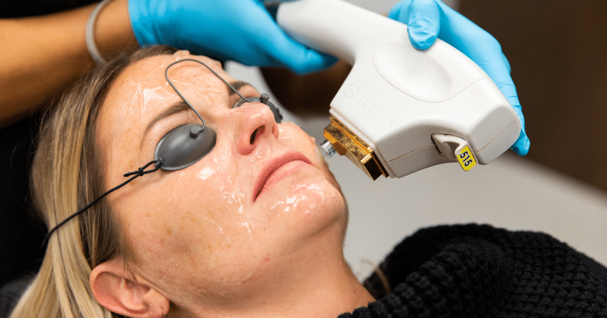 Discover The Magic of Light Therapy with Sciton BBL - Glamor Medical Boca Raton Boutique Spa