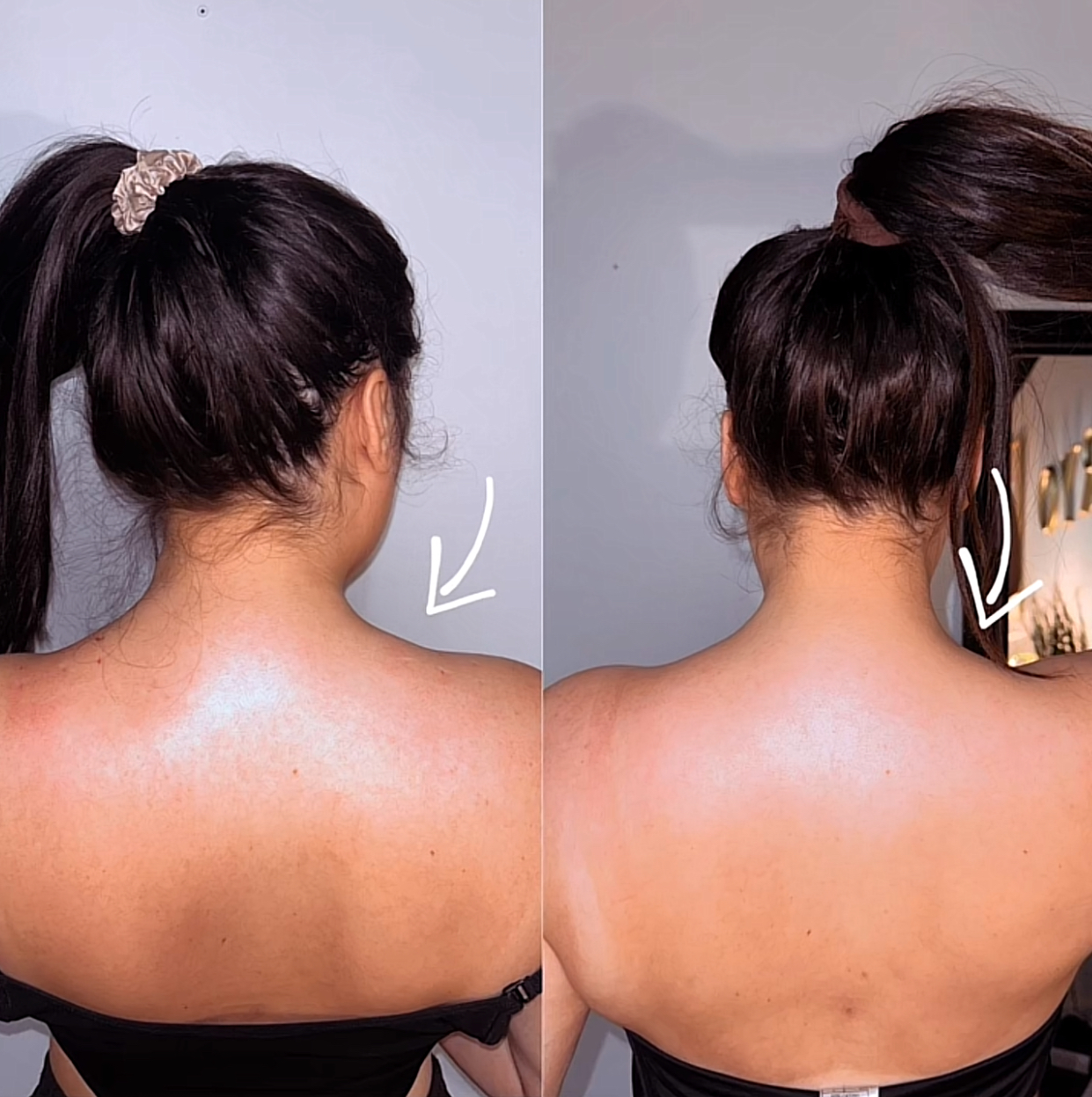 Beyond the Face: How Muscle Relaxants Can Transform Your Body - Glamor ...