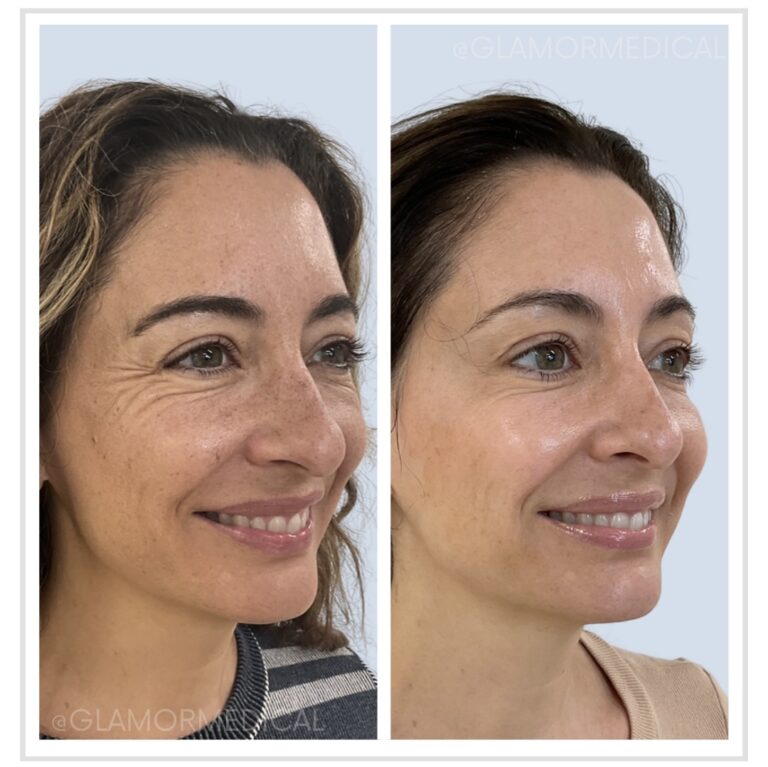 Staying Ahead in Modern Aesthetics - Glamor Medical Boca Raton Boutique Spa